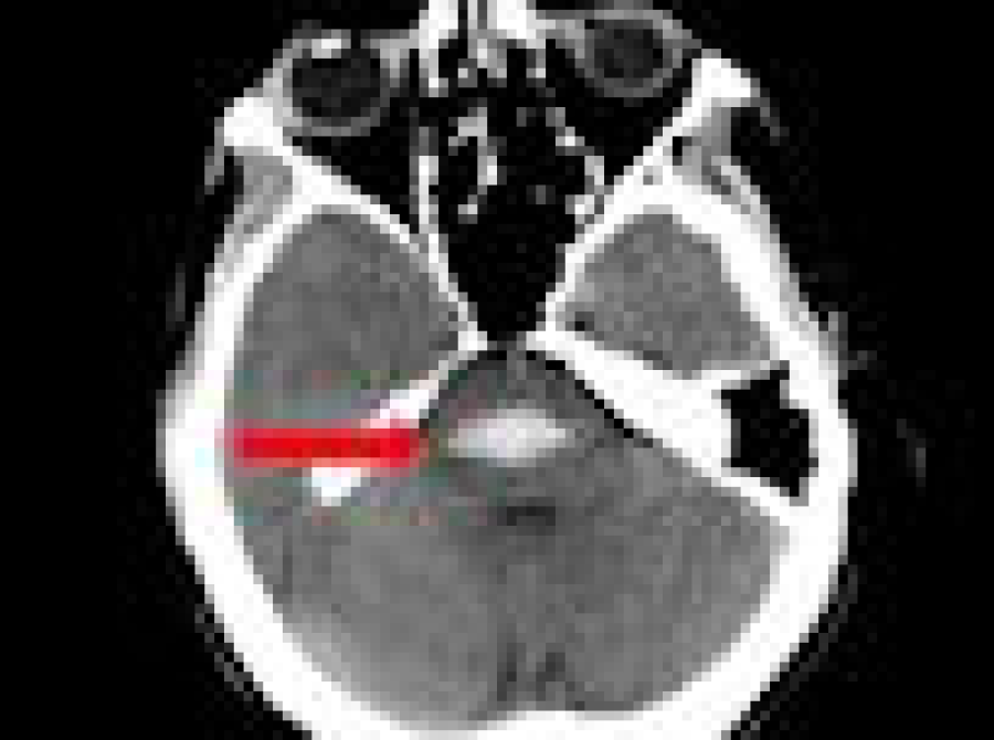 Curriculum : ebrain Curriculum | ebrain